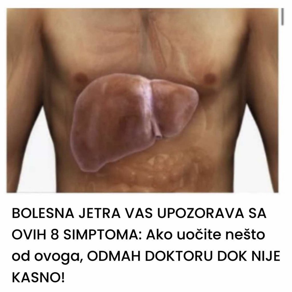 BOLESNA JETRA VAS UPOZORAVA SA OVIH 8 SIMPTOMA: Ako uočite nešto od ovoga, ODMAH DOKTORU DOK ...